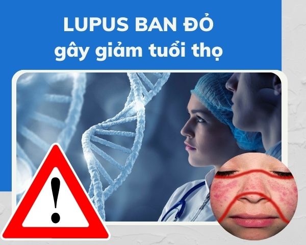 Cảnh báo: Lupus ban đỏ có thể khiến bạn giảm tuổi thọ